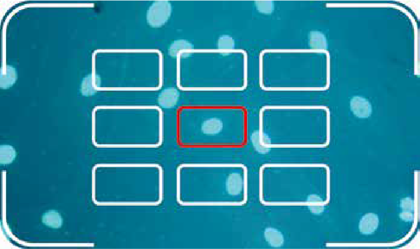 BS-2097MM Research Inverted Microscope with Micromanipulator Configuration