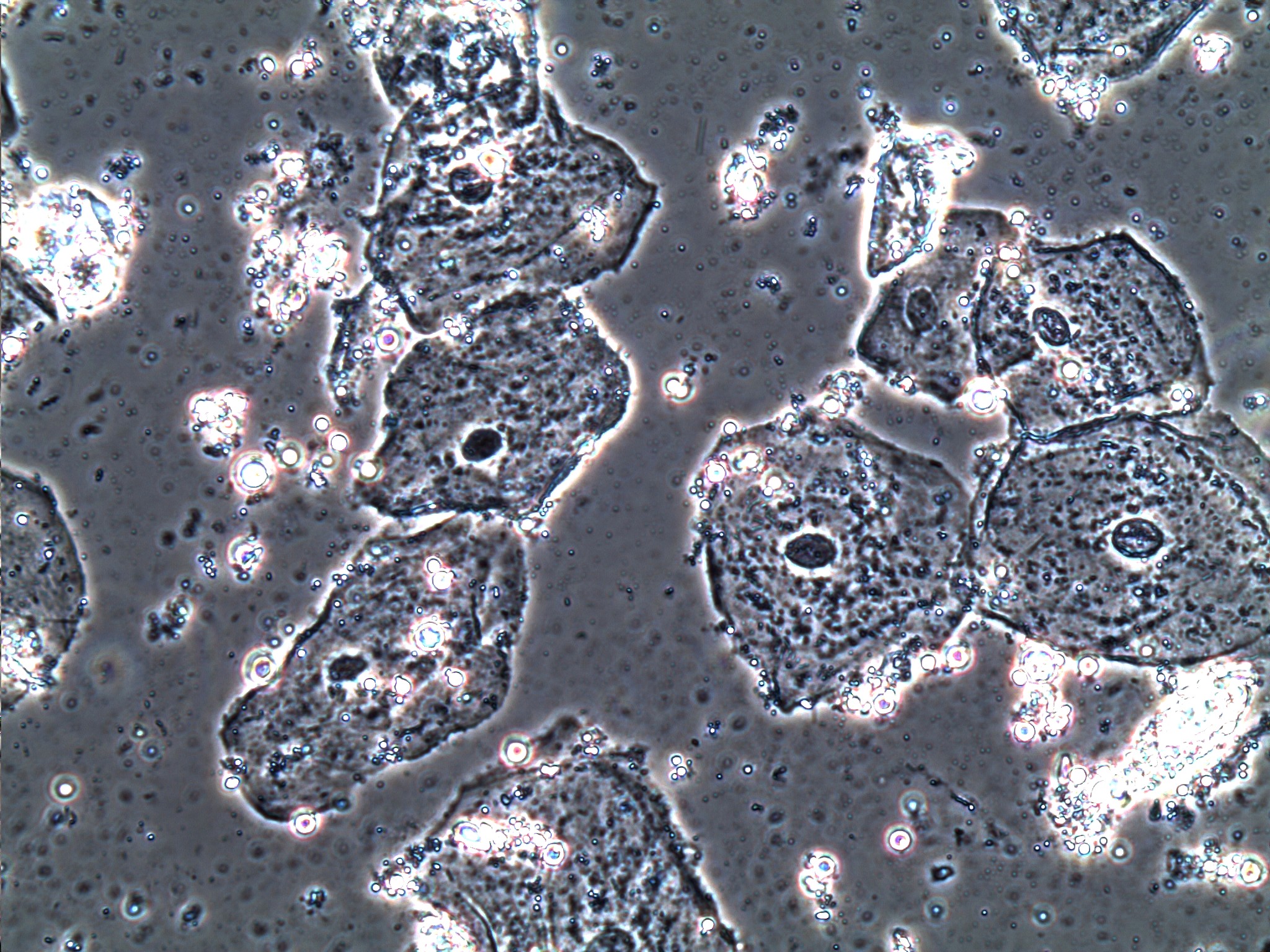 BS-2048B Binocular Biological Microscope