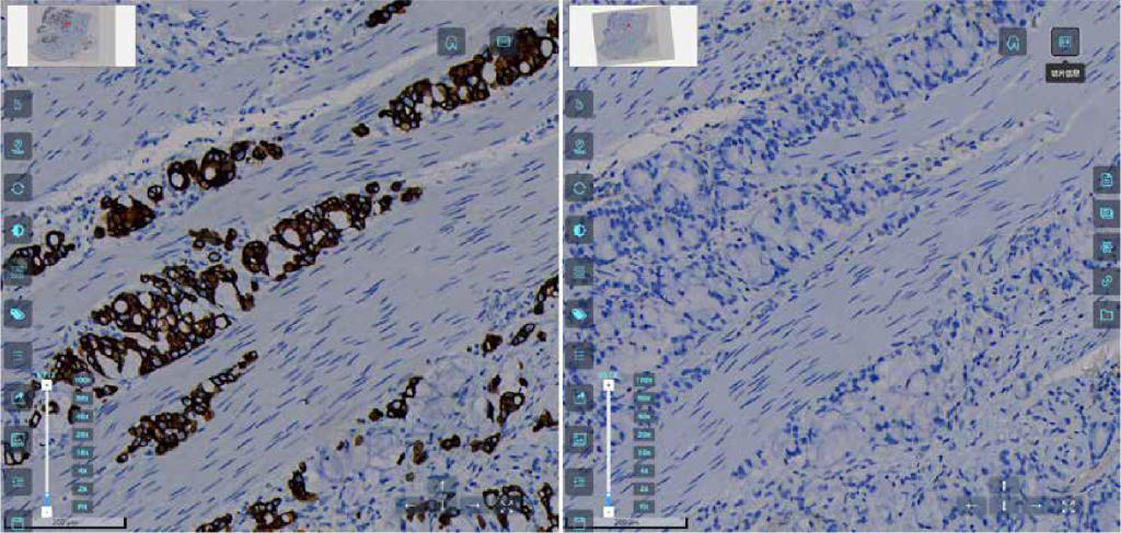 Scanpro2-6 Digital Pathology Section Scanner