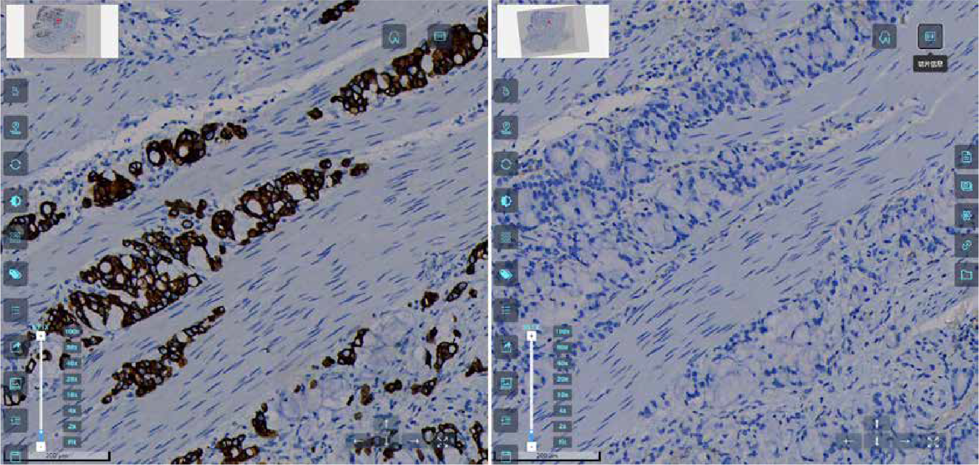 Scanpro2-6 Digital Pathology Section Scanner
