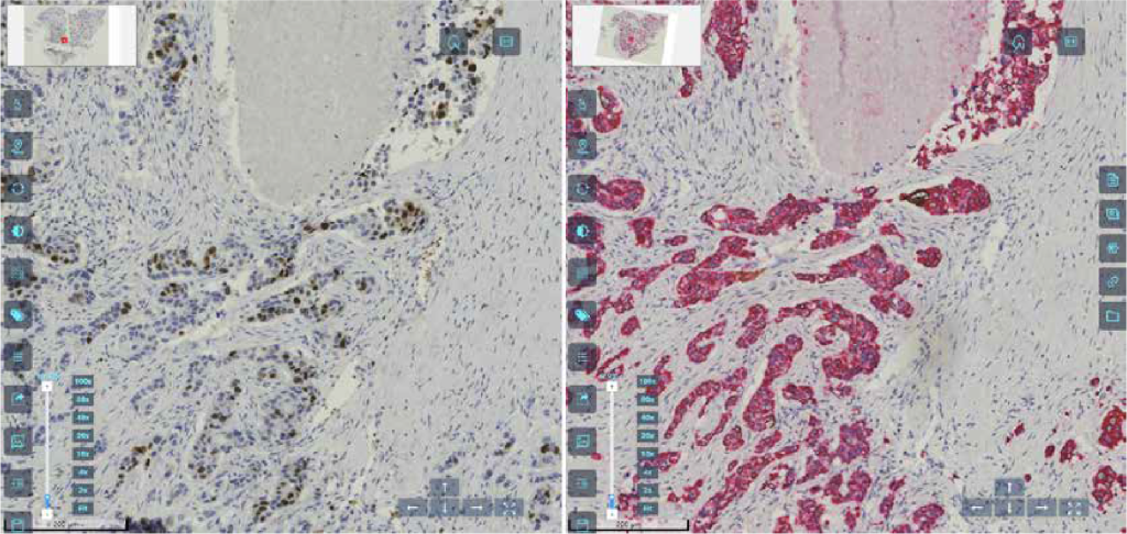 Scanpro2-6 Digital Pathology Section Scanner