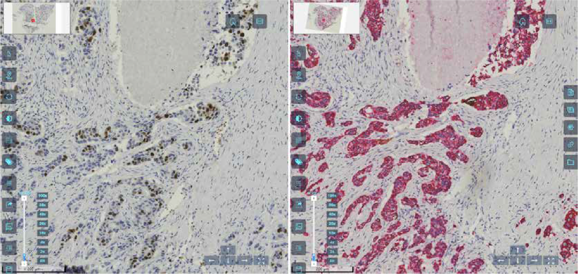 Scanpro2-6 Digital Pathology Section Scanner