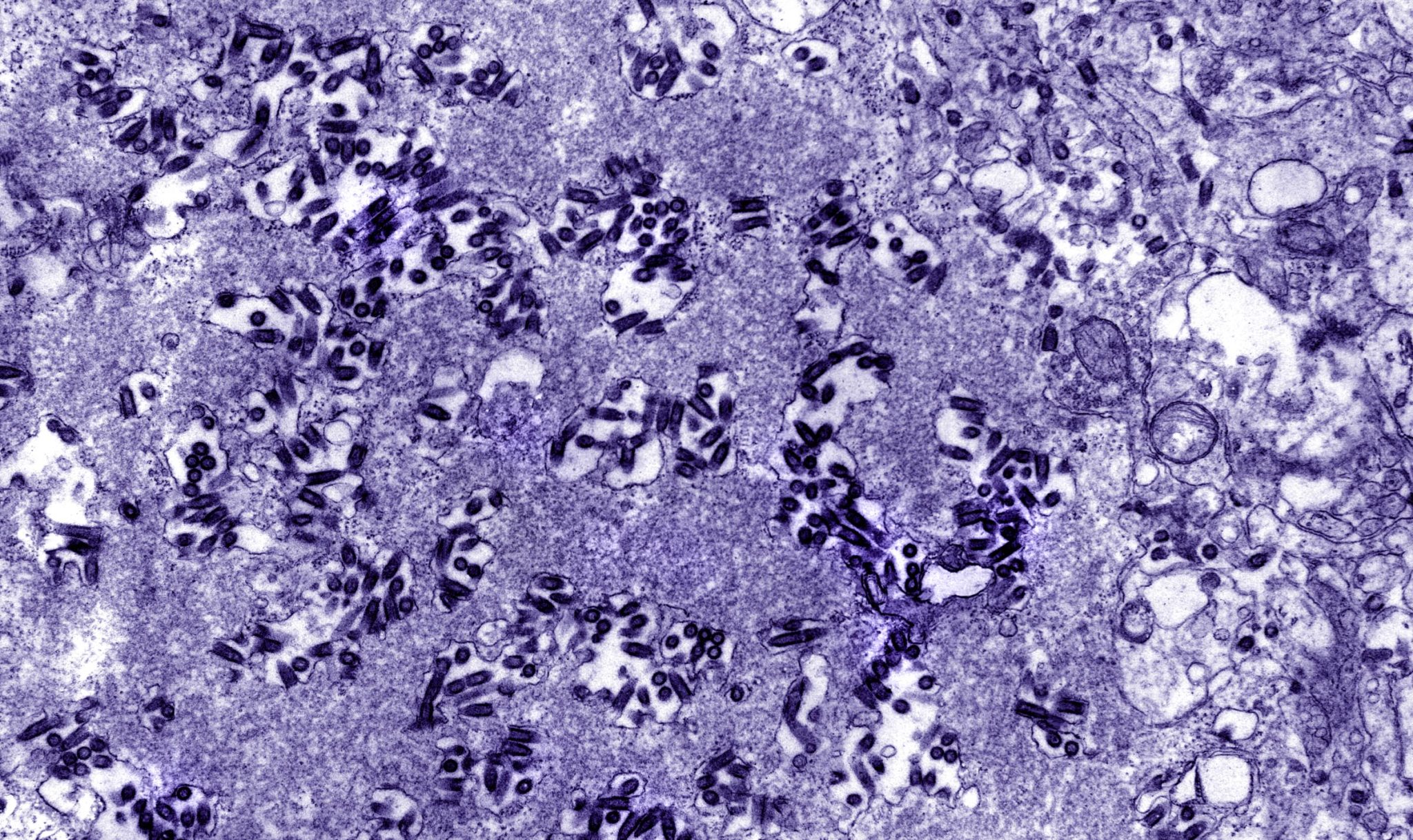 Rabies Microscopy Instrument Solution